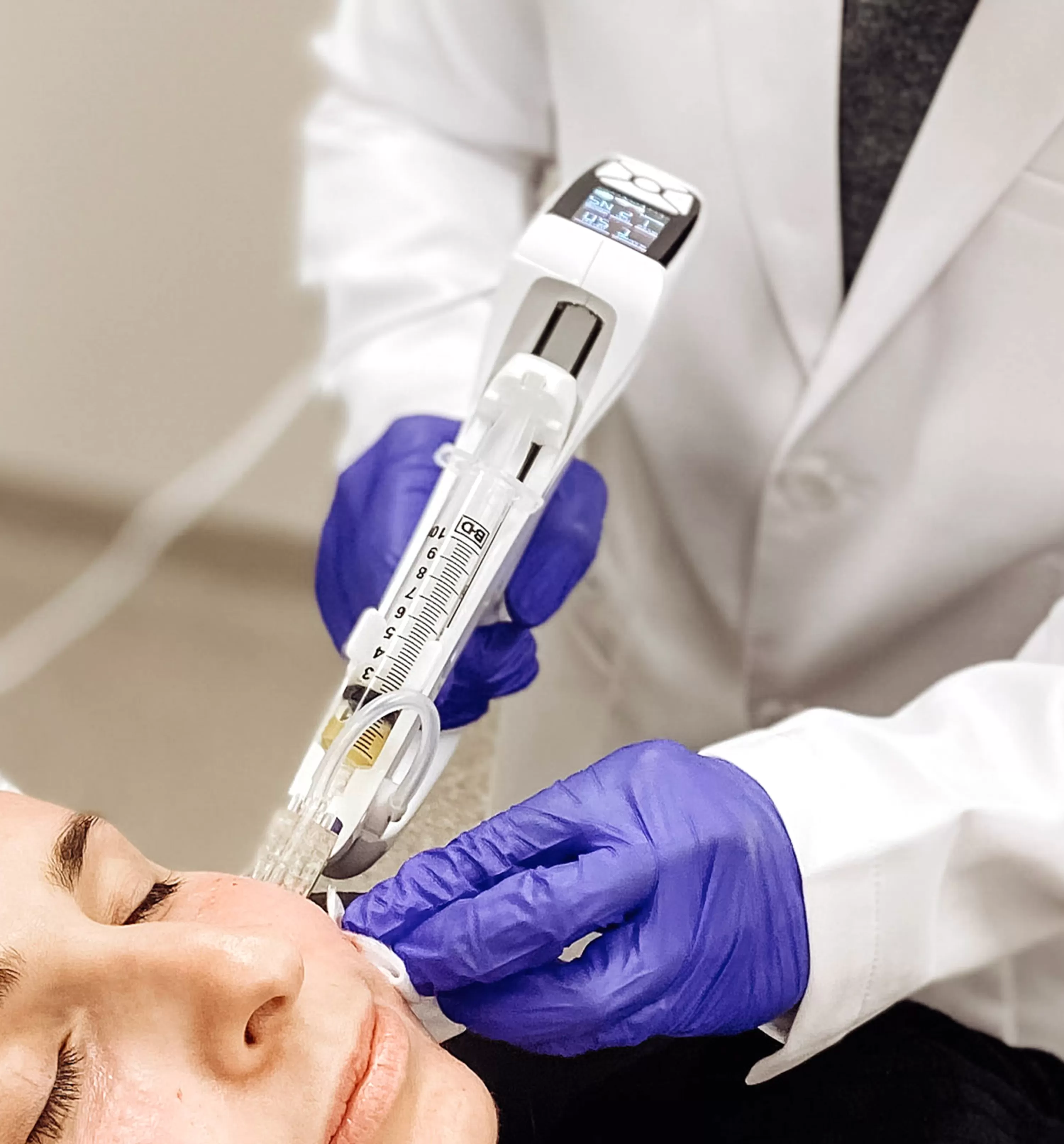 PRP Skin Injection | Canberra | R Clinic