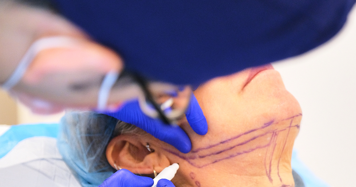 FaceTite & AccuTite | Canberra | R Clinic