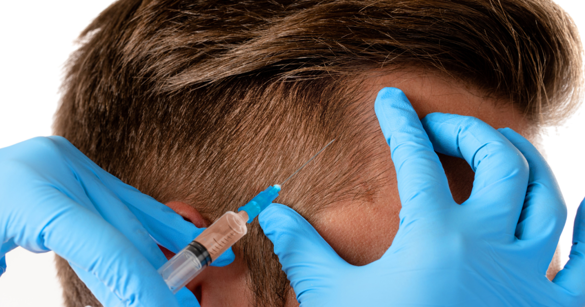 PRP - Hair Growth Injections: Preparation and Aftercare