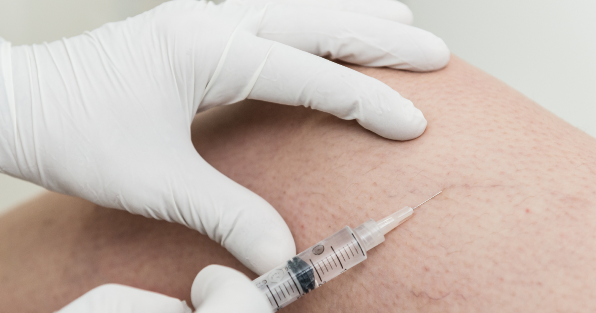 Preparation and aftercare for your Sclerotherapy treatment