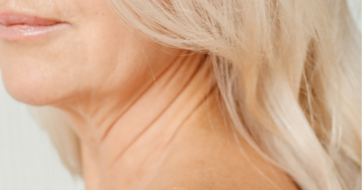 Non Ablative Laser For Skin Resurfacing In Canberra Skin Rejuvenation